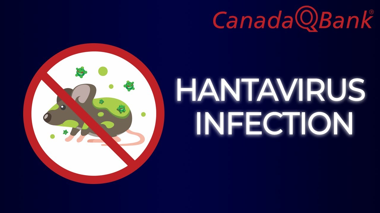 Hantavirus Explained | Symptoms, Transmission & Management | CanadaQBank