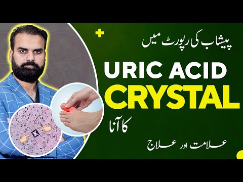 Uric Acid Crystal in Urine Test Report Causes & Treatment in Urdu | Peshab Mein Crystal