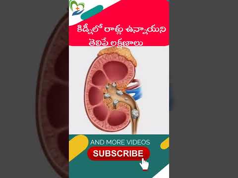 కిడ్నీలో రాళ్లు ఉన్నాయని తెలిపే లక్షణాలు#shorts #youtubeshorts #telugu #health #telugushorts #viral