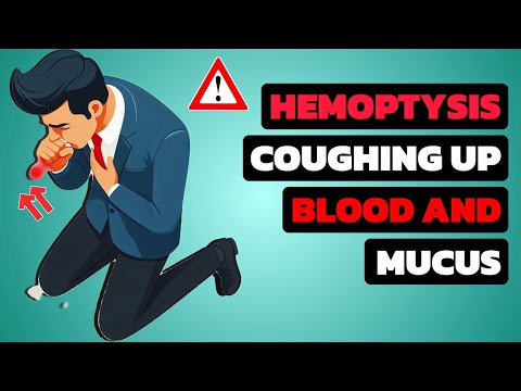What causes hemoptysis or coughing up blood? How to treat hemoptysis