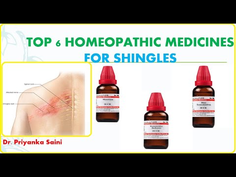 POST HERPETIC NEURALGIA / SHIGLES TREATMENT || TOP 6 HOMEOPATHIC MEDICINES FOR SHINGLES |Dr.Priyanka