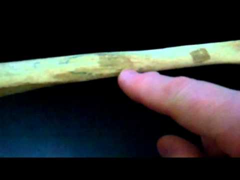 HUMERUS