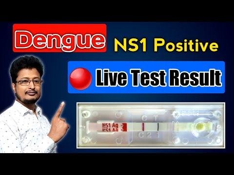 Dengue NS1 Positive | Dengue Patient | Dengue Fever | Dengue Test Live | #shorts