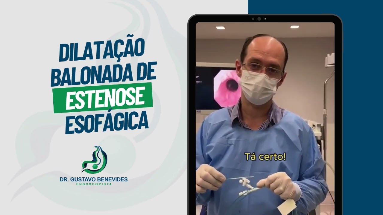 Dilatação balonada de estenose esofágica