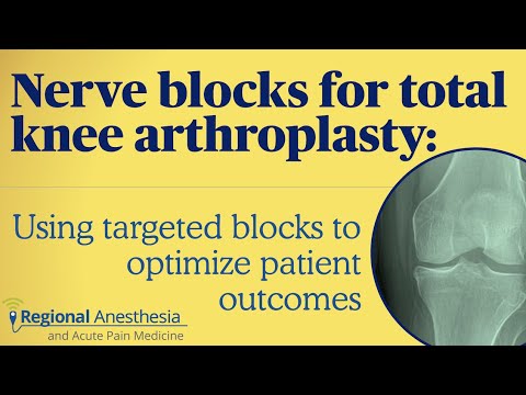Nerve Blocks for Total Knee Arthroplasty: Using Targeted Blocks to Optimize Patient Outcomes