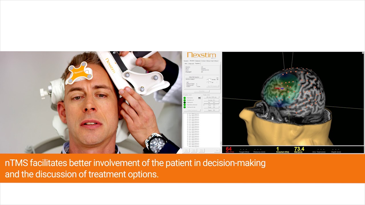 Nexstim navigated TMS is helping to make brain surgery safer (short video)