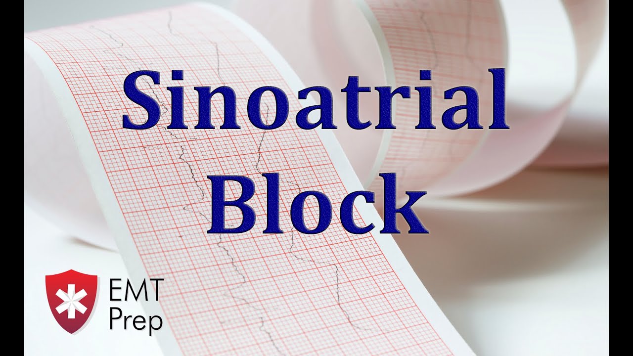 Sinoatrial Block ECG - EMTprep.com