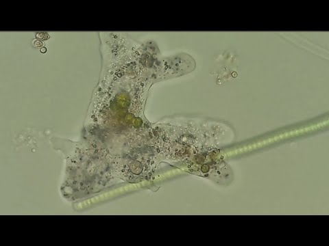 Amoeba sp.