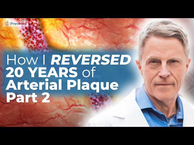 Reversing Arterial Age: Insights from My Journey and Scores | Galaxy