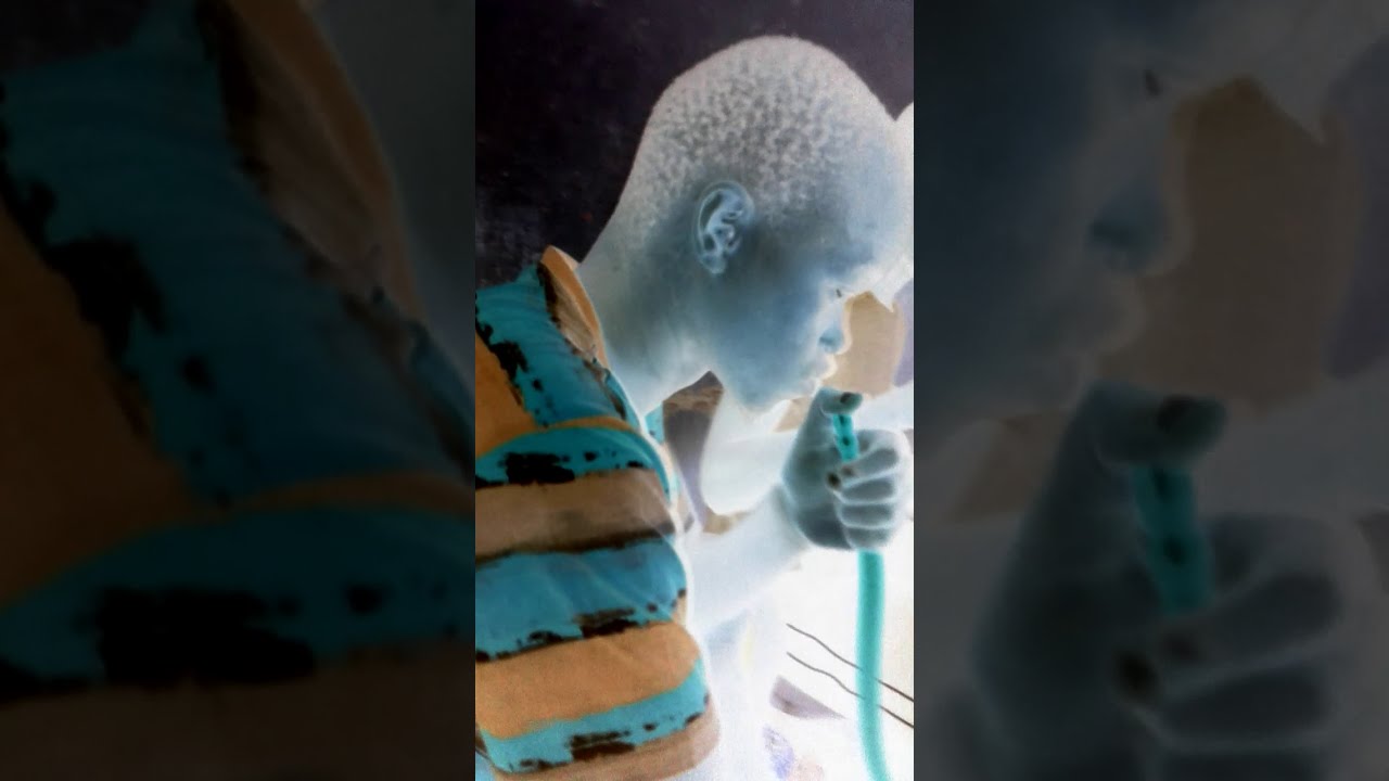 skomplaz