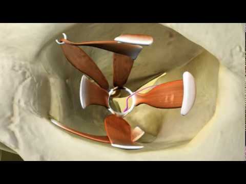 Part 5 of 14 CN VI - Abducens Nerve pathway(s) narrated by Dr. Carmine Clemente