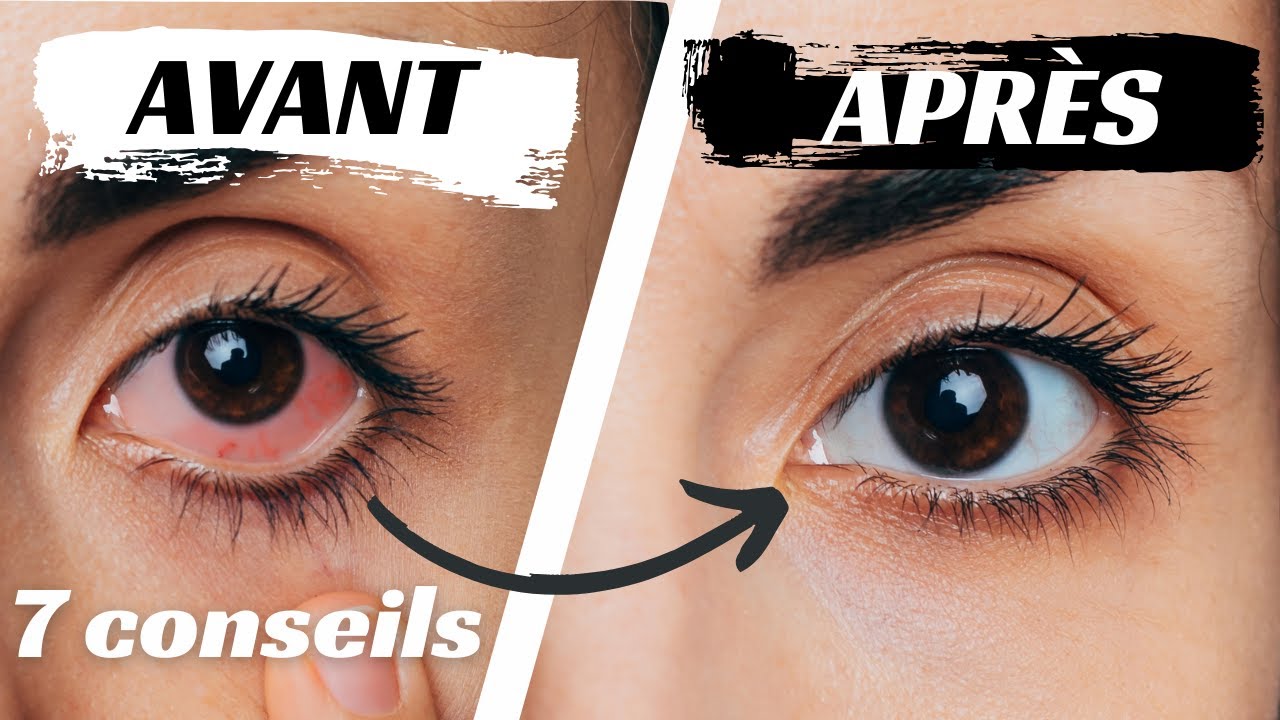 7 Conseils pour Éviter les  Yeux Secs