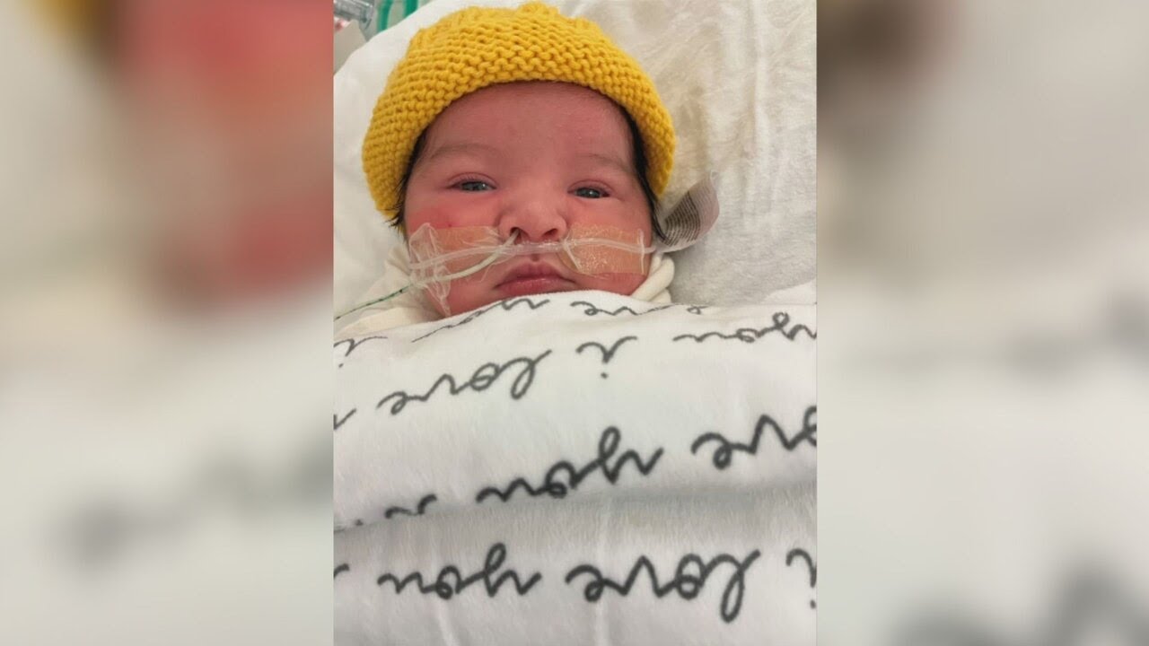 Las Vegas ‘Baby Incredible Hulk’ dies after battle with rare genetic disorder