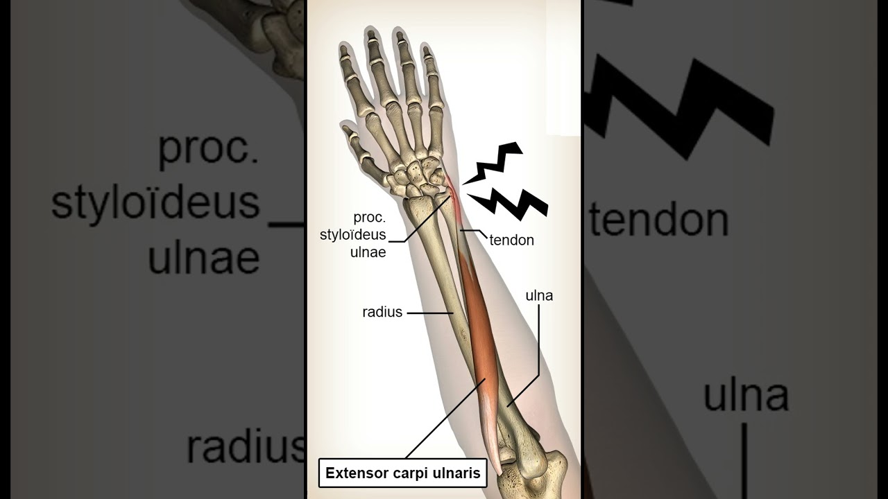 💪 ECU Synergy Test — Quick Wrist Stability Check! #wristpain #meded #atc #physiotherapy  #ortho