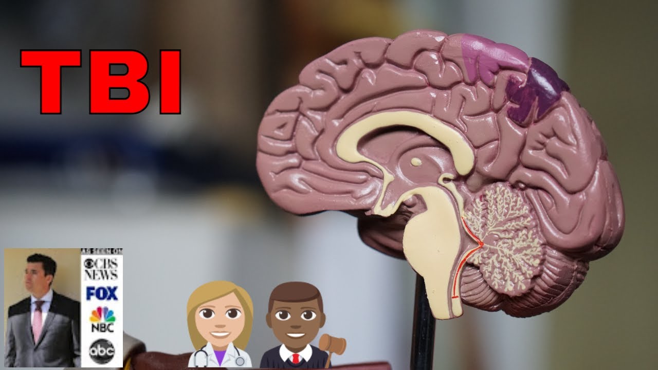 TBI Lawyers discuss the Glascow Coma Scale (GCS) - Traumatic Brain Injury Series