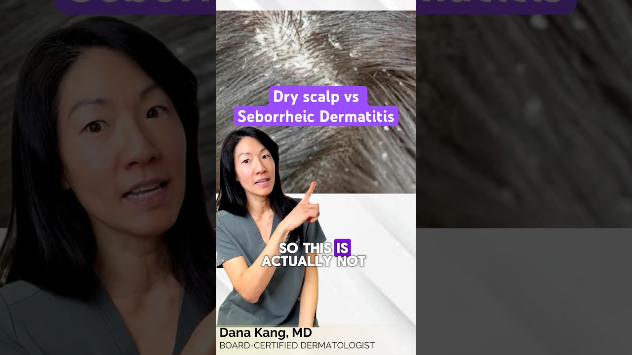 Dry Scalp? Might be Seborrheic Dermatitis! | Dr. Dana Kang