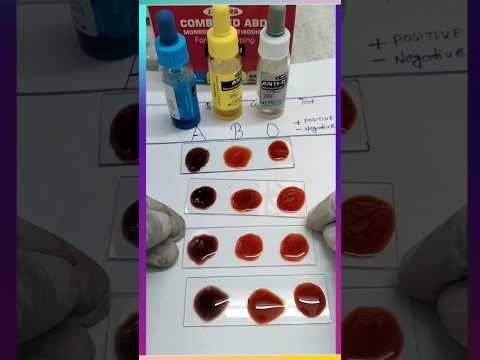Breaking the Code: Mastering the Phlebotomy State Test in 5 Simple ...