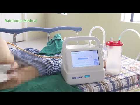 Negative Pressure Wound Therapy, Negative Pressure Wound Therapy ...