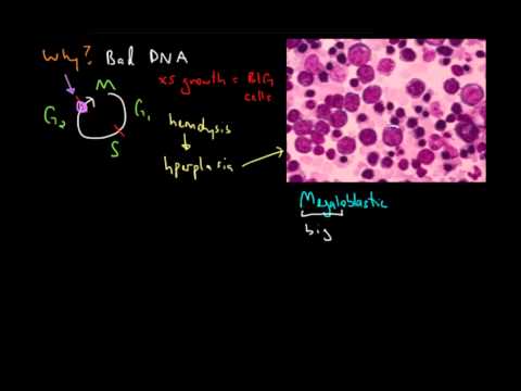 Macrocytic Anemia