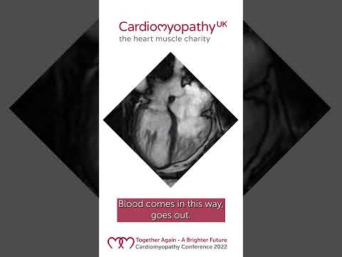 Different types of cardiomyopathy