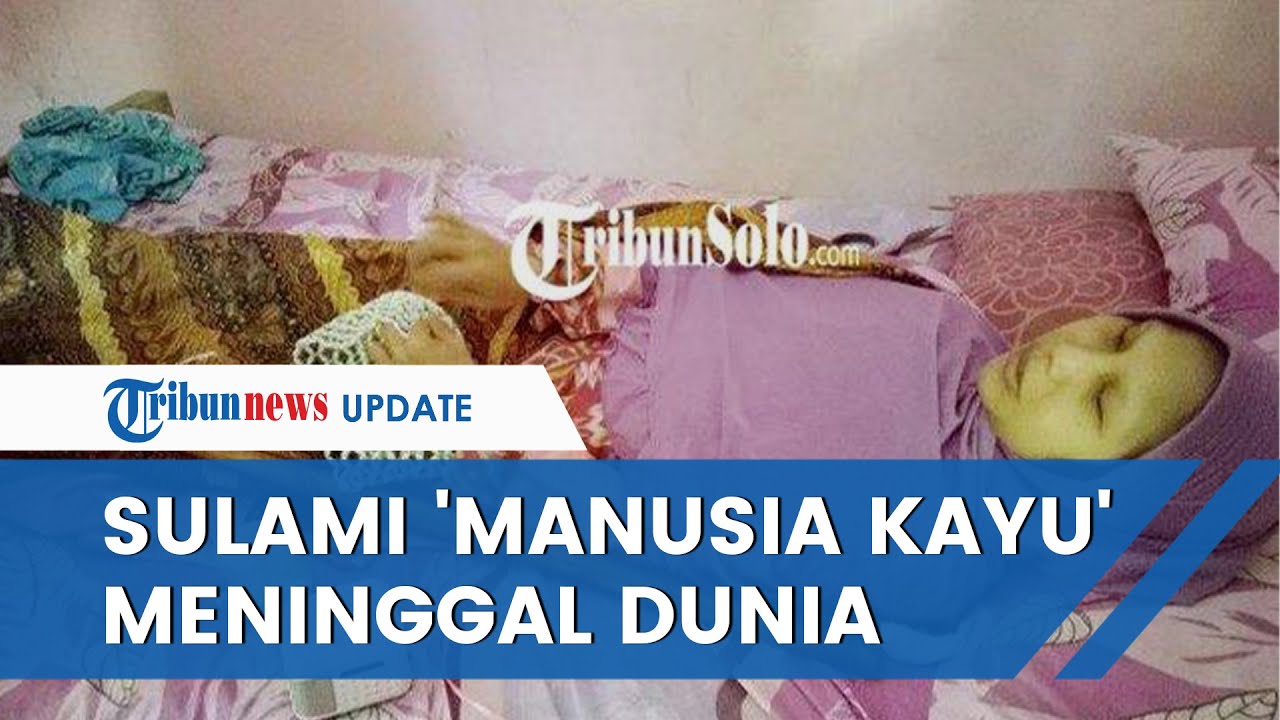 Sulami 'Manusia Kayu' Asal Sragen Meninggal Dunia, Keluarga Ungkap ...