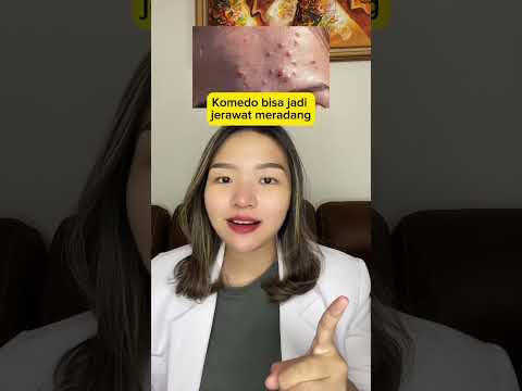3 FAKTA KOMEDO YANG HARUS KAMU KETAHUI !! #komedo #komedohilang #aestheticdoctor #skincaretips