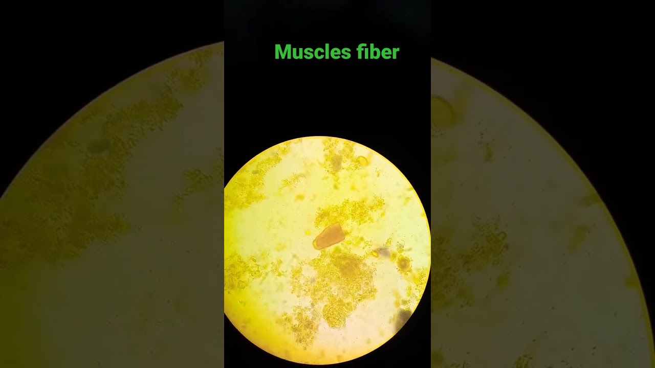 muscle fiber in Stool at 40x #microscope