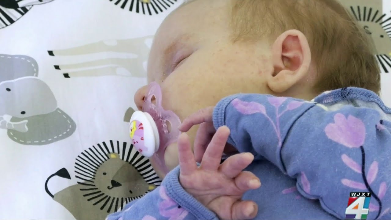 Updated Sleep Guidelines for SIDS: Babies should sleep on their backs