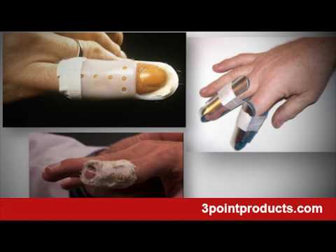 3PP Oval-8 Finger Splint
