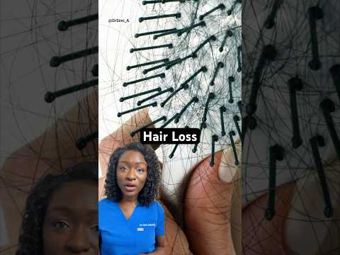 Why Is Your Hair Falling Out? Hair Loss In Women | Telogen Effluvium