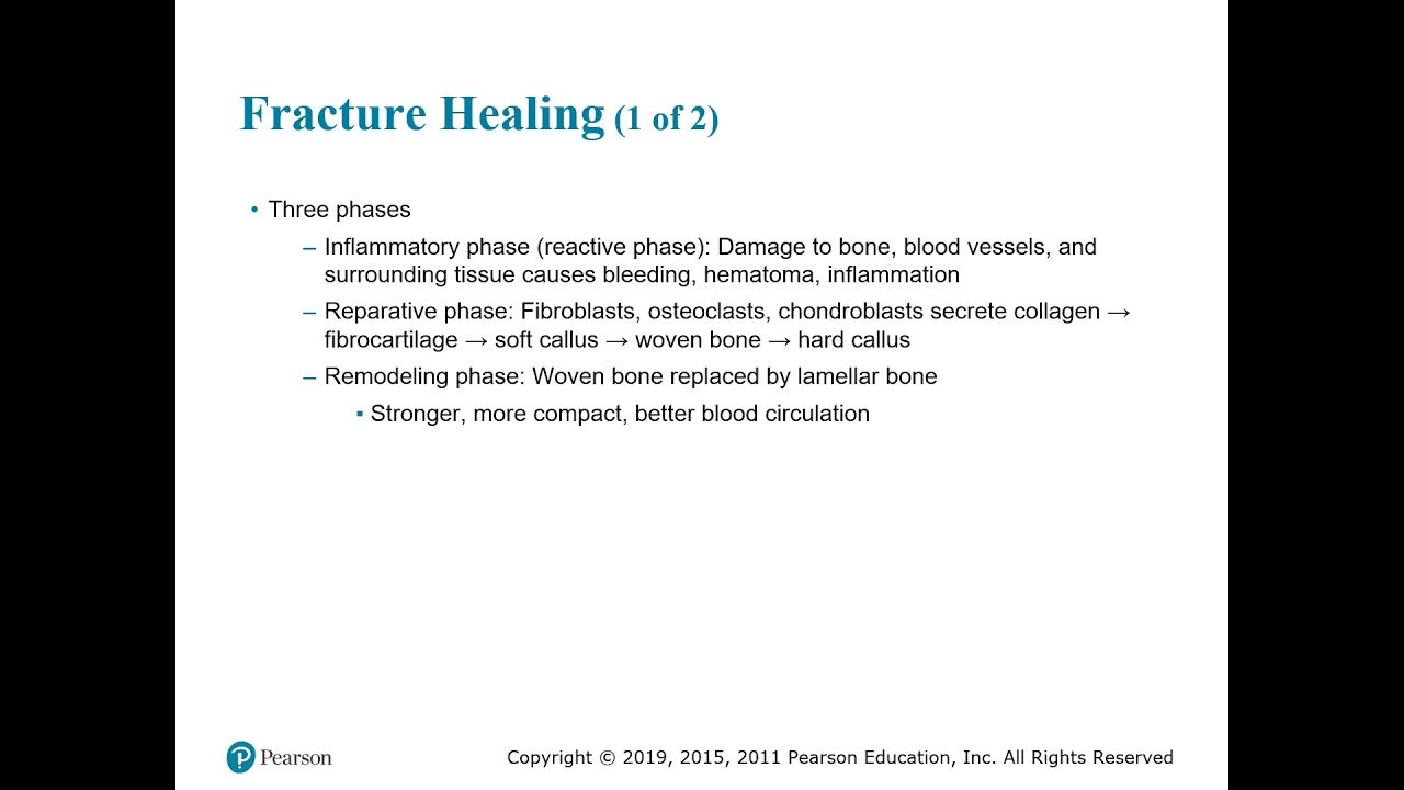 Module One Exemplar 13 5 Fractures PPT