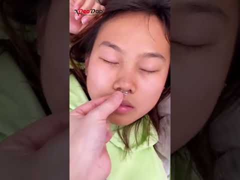 Acusnore Anti Snore Magnetic Nose Clip #snoring #nose