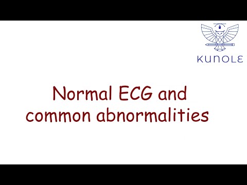 ECG basics (1.9). Normal ECG and common abnormalities