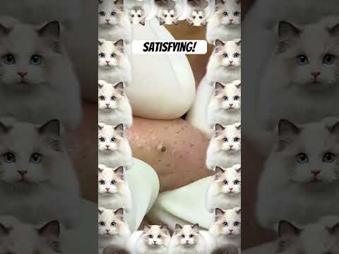 Wow! #pimple #pimples #pimplepopping #shortsfeed #shortvideo #shorts #short #youtubeshorts #youtube