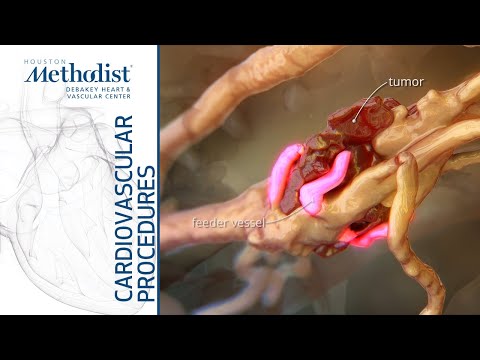 Patient Specific Animation: New Concept in Medical Education (Lumsden MD, Chinnadurai MBBS, Blausen)