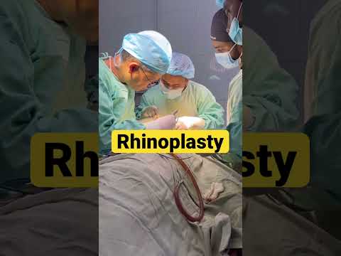 Rhinoplasty in Bangladesh | Septorhinoplasty in Bangladesh | Nose surgery in Bangladesh | Dr Iqbal