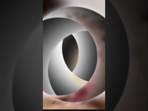 Naked mole rat #funny #shortsviral #weird