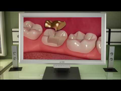 Patient Education Software - Medivision CIC Pro 2017