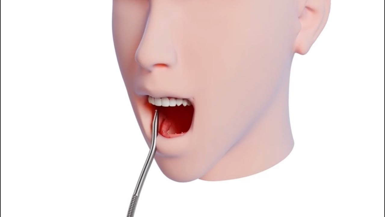 How To Use DentaGrip tool | DentureBuddy.com