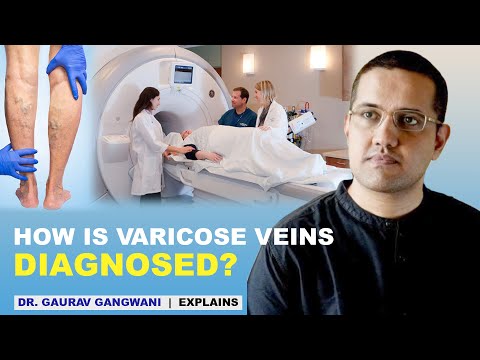 Diagnosis of Varicose veins | Varicose veins diagnosis | Doppler ultrasound | Dr. Gaurav Gangwani