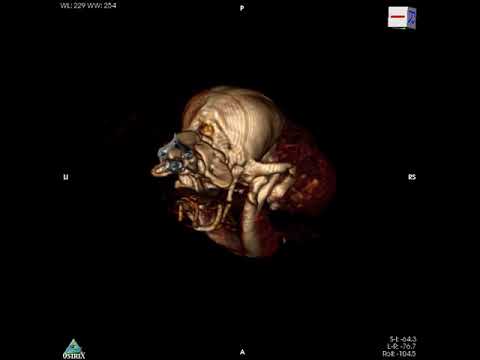 odontogenic tumor - www.animalsurgicalcenter.com