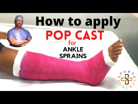 How to Apply POP Cast for Ankle Sprains, Sports Ligament injuries & Stress Fractures