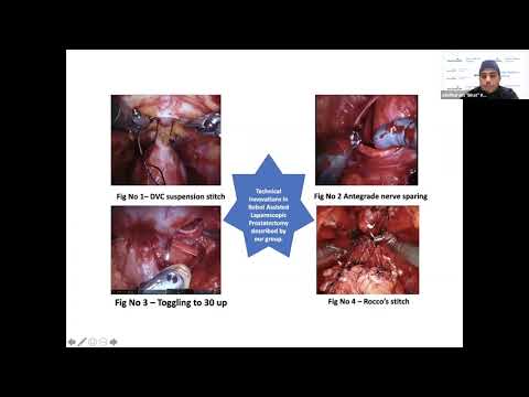 Disparities in Prostate Cancer-Dr. Vipul Patel