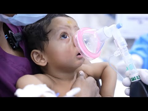 Baby Goes Under Pediatric Anesthesia