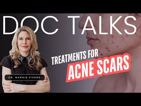 Treatment Options for Acne Scars | with Dr. Marnie Fisher at Kingsway Dermatology
