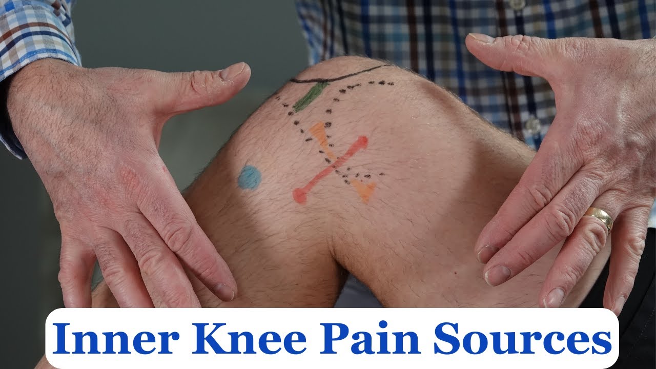 5 Most Common Sources of Inner Knee Pain