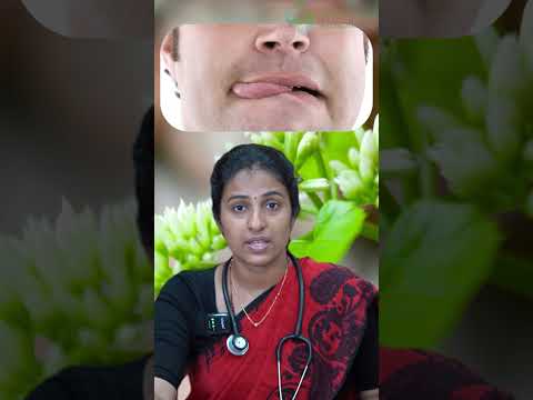 Epilepsy | வலிப்பு நோய் | Fits | Tamil #shorts #trending