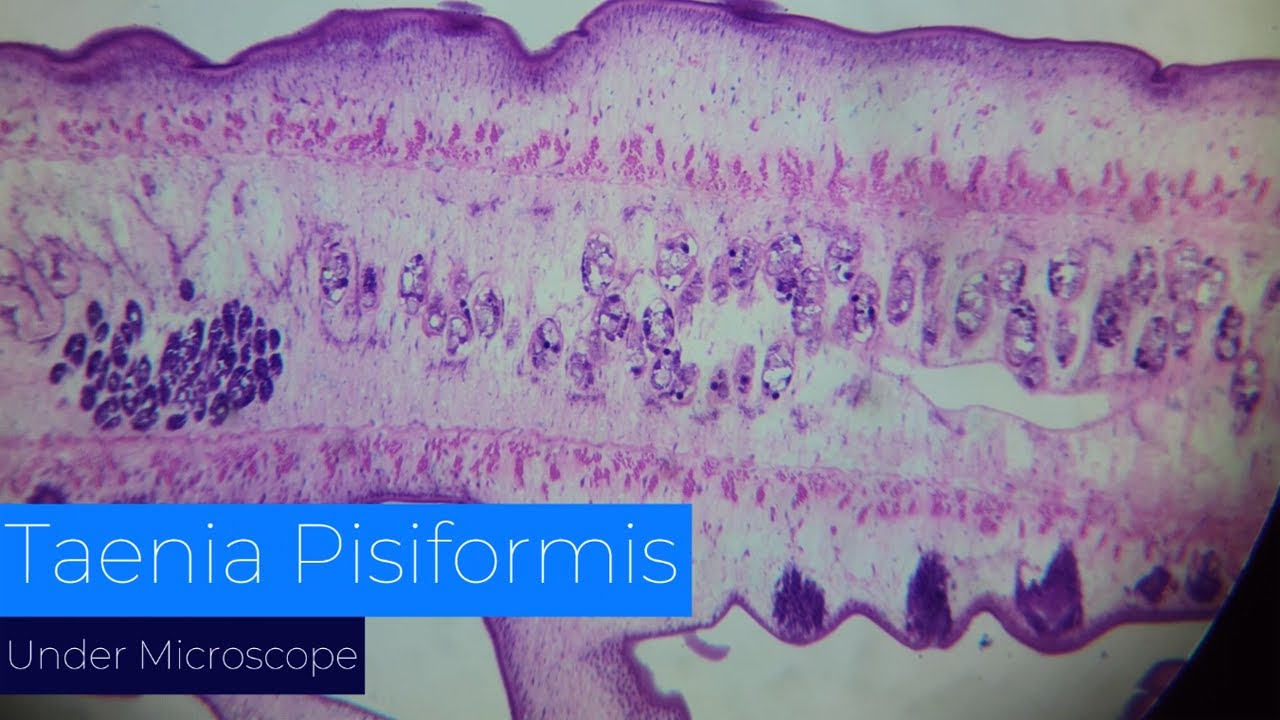 Taenia Pisiformis under Microscope