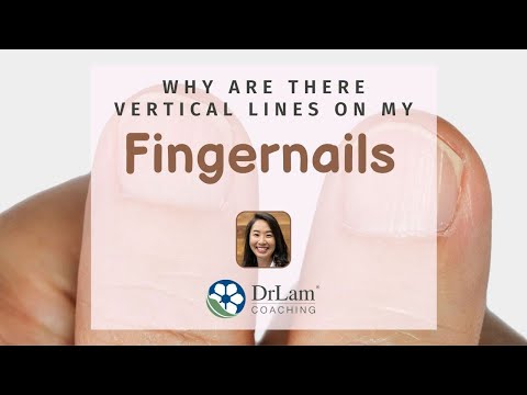 Why Are There Vertical Lines On My Fingernails?