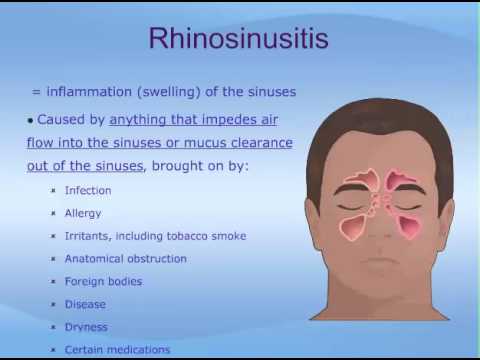 What are the Sinuses